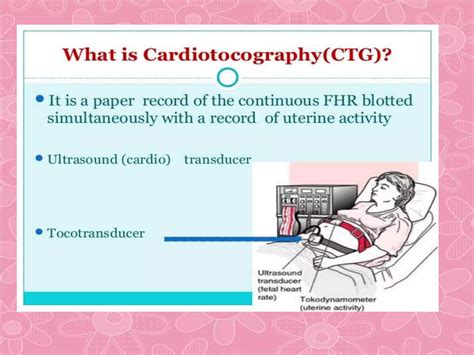 Fetal Monitoring 2 Ppt