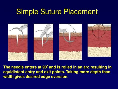 PPT - Wound Closure Workshop PowerPoint Presentation, free download ...