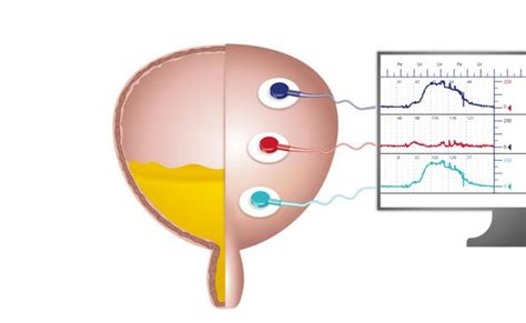 Urodynamics Test System Potent Medical