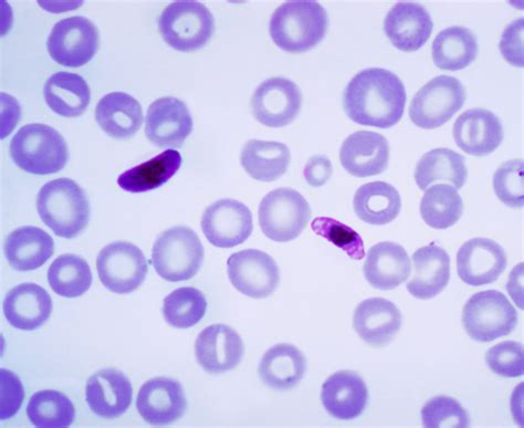 Plasmodium Parasites Scientists Against Malaria