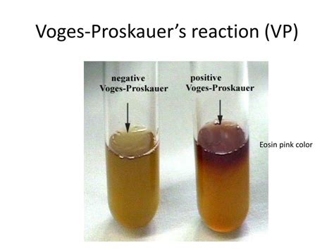 Ppt Biochemical Characterization Of Bacteria Powerpoint Presentation