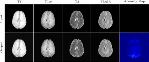 Figure 2 From Diffusion Models For Medical Anomaly Detection Semantic Scholar