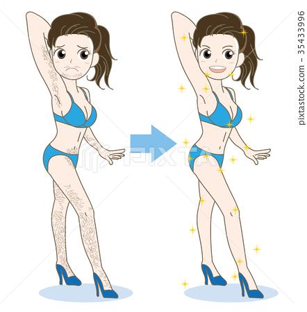 Este · Womens Whole Body Hair Loss · Before After Stock Illustration