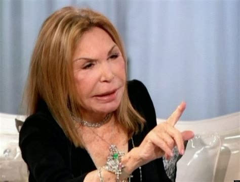 Elsa Patton The Worst Example Of Plastic Surgery Disaster 28 Pics