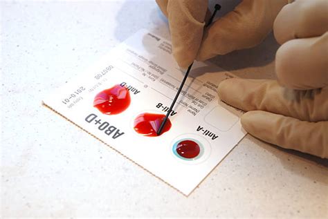 The Differences Between Hyperkalemia And Hypokalemia