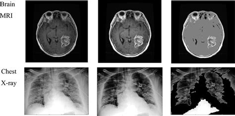 Outcomes For Image Pre Processing And Segmentation Download