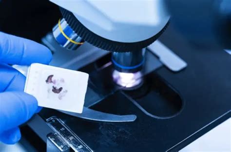 The Importance Of Ffpe Tissue In Histopathology A Comprehensive Guide