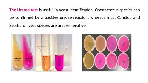 Practical Medical Mycology Lab 8 Yeast Identification Introduction