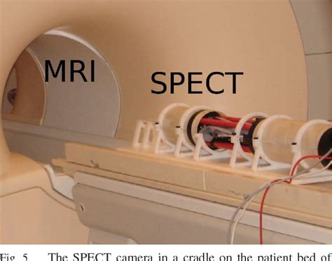 Figure 1 From A Spect Camera For Simultaneous Spectmri Semantic Scholar