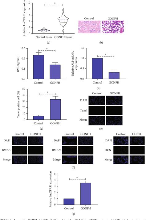 [pdf] Long Noncoding Rna Zinc Finger Antisense 1 Affects Glucocorticoid