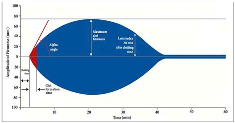 Rotem ® Parameters Clotting Time Ct Corresponds To The Time From The Download Scientific