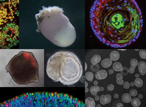 What Are Organoids From Stem Cells To Mini Organs Lambda Biologics