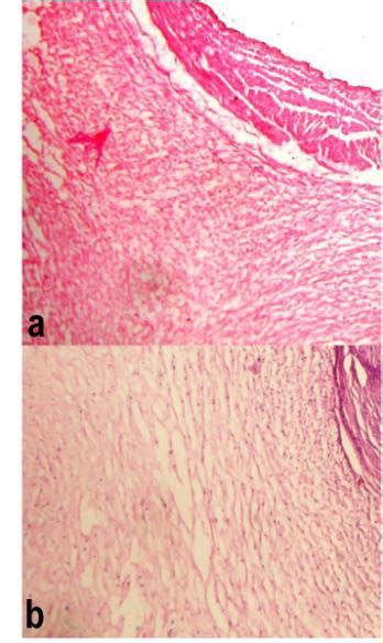 Whartons Jelly Area Of Umbilical Cord A Normal Pregnancy B
