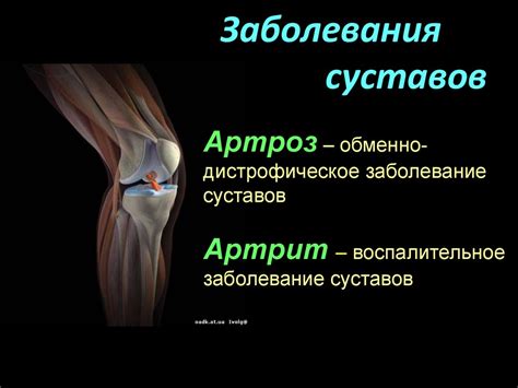 Заболевания суставов - презентация онлайн