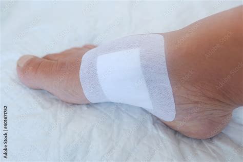 Closeup White Plaster On Skin Healing Wound Treatment Ulcer On Female