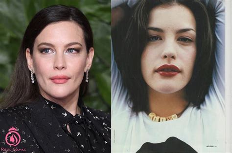 تزریق ژل لب مدل عروسکی باربی فیلم تزریق کلینیک رازی