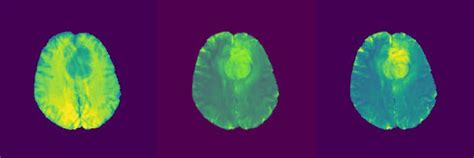 Github Ambidextrous9 Unet On Brain Mri Images Re Generate Brain Mri Images