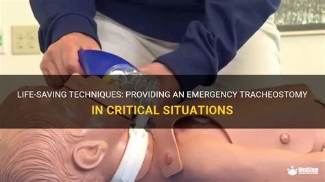 Life Saving Techniques Providing An Emergency Tracheostomy In Critical Situations MedShun