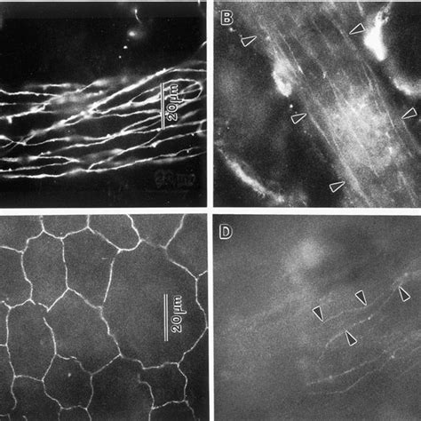Immuno Electron Microscopic Analysis Of Occludin Expression In Vessels Download Scientific