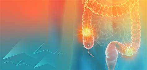Fda Approves Oncomine Dx Express Test For Tumor Profiling And As