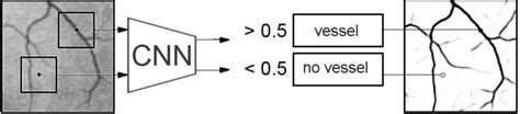 the common scheme of pipeline of vessel segmentation download