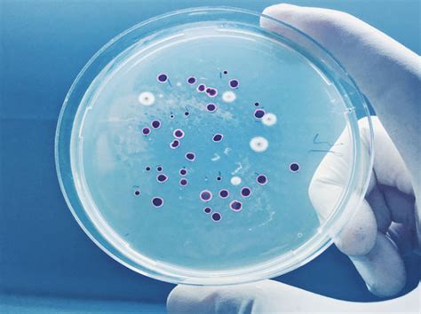 Bactériologie Clinique Internationale Belair