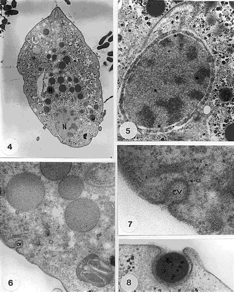 Infeccao Por Trichomonas Vaginalis Da Vinci Medicina Integrada A