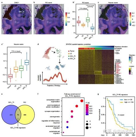 Nc文献解读 空间全长转录组学揭示恶性胶质瘤中放射状胶质干细胞的生态位特异性富集和脆弱性 知乎