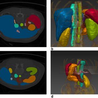 PDF Advances In Medical Image Analysis With Vision Transformers A Comprehensive Review