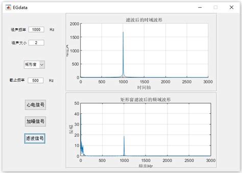 基于matlab心音信号分析系统 gui界面 索炜达 猿创