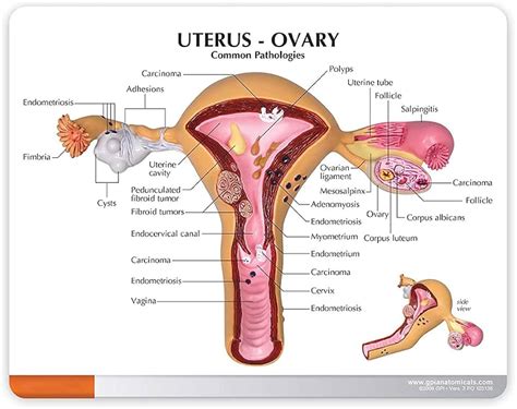 Uterus Model Labeled نتيجة الصورة لـ Uterus And Ovary