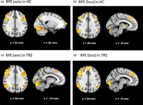 Neural Response Correlating With Reward Prediction Error Rpe In Download Scientific Diagram