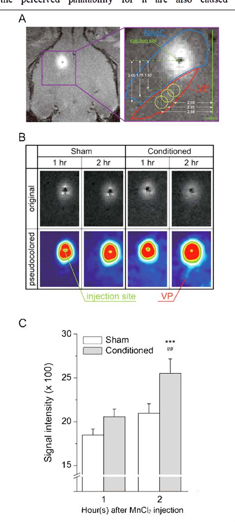 Figure 2 From Neural Substrates For The Retrieval Of Conditioned Taste Aversion Revealed By