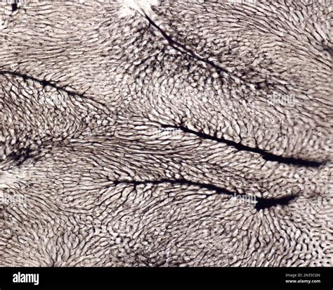 The Study Of An Organ Microvasculature Usually Implies The Filling Of