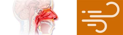 Rinitis Tipos Causas Síntomas Y Tratamiento