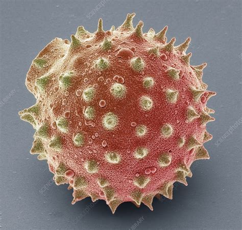 Foraminiferan Sem Stock Image C023 1768 Science Photo Library