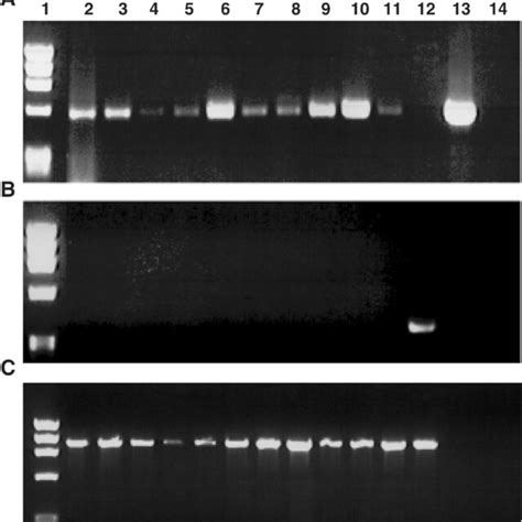 an rt pcr assay of jup exon 1a a exon 1b b and gapdh c rna