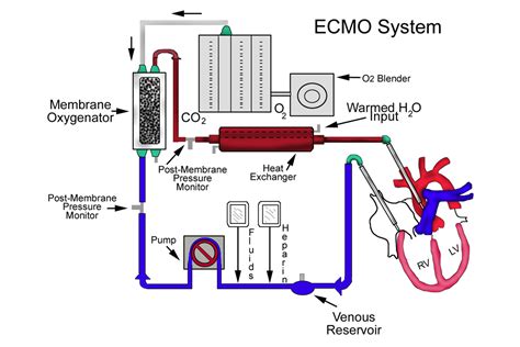 Ecmo Circuit