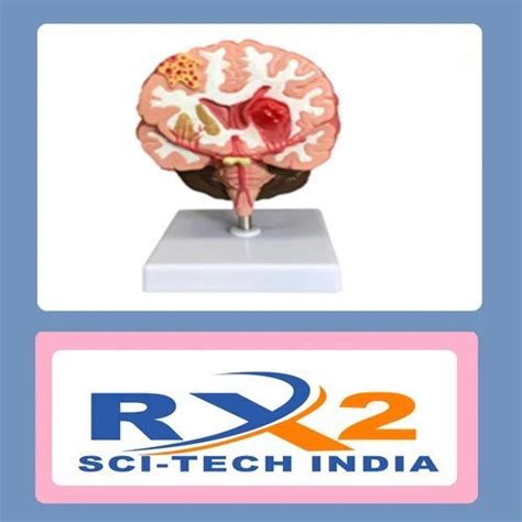 Brain Stroke Model At Best Price In Greater Noida Uttar Pradesh Rx2 Sci Tech India