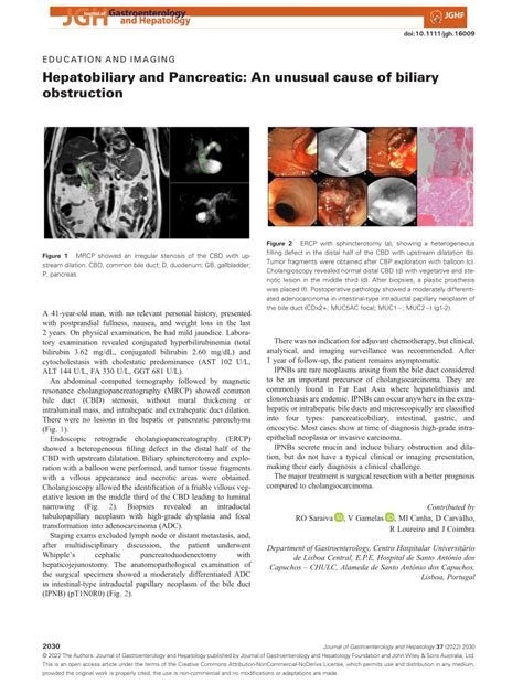 Pdf Hepatobiliary And Pancreatic An Unusual Cause Of Biliary Obstruction
